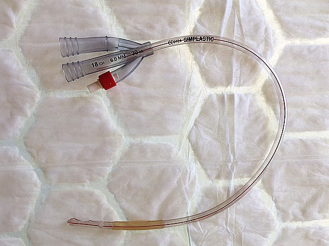 An introduction to the use of catheters during and after radical ...