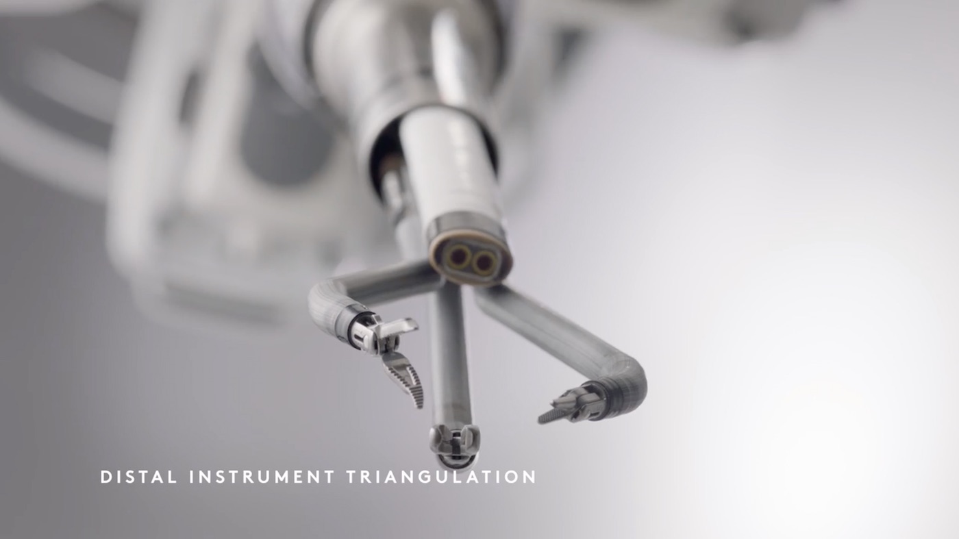 The da Vinci Single Port robot - faster recovery than before - Santis ...